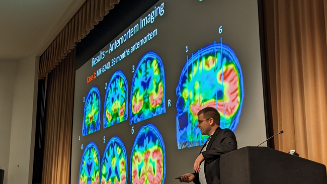 UW Madison Researchers Present, Win Awards at Human Amyloid Imaging (HAI) Conference | Wisconsin ...